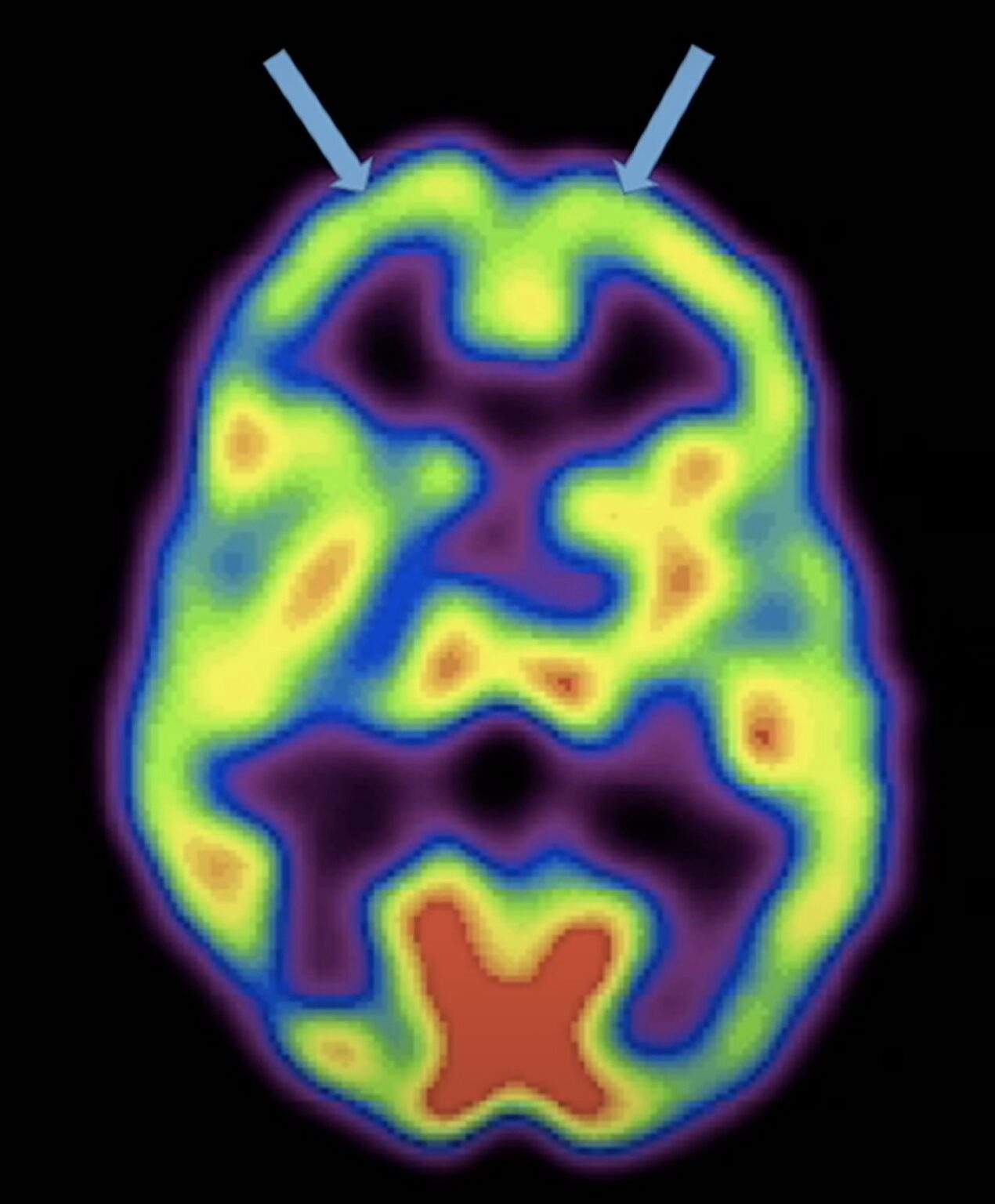 How Enlightenment Changes Your Brain